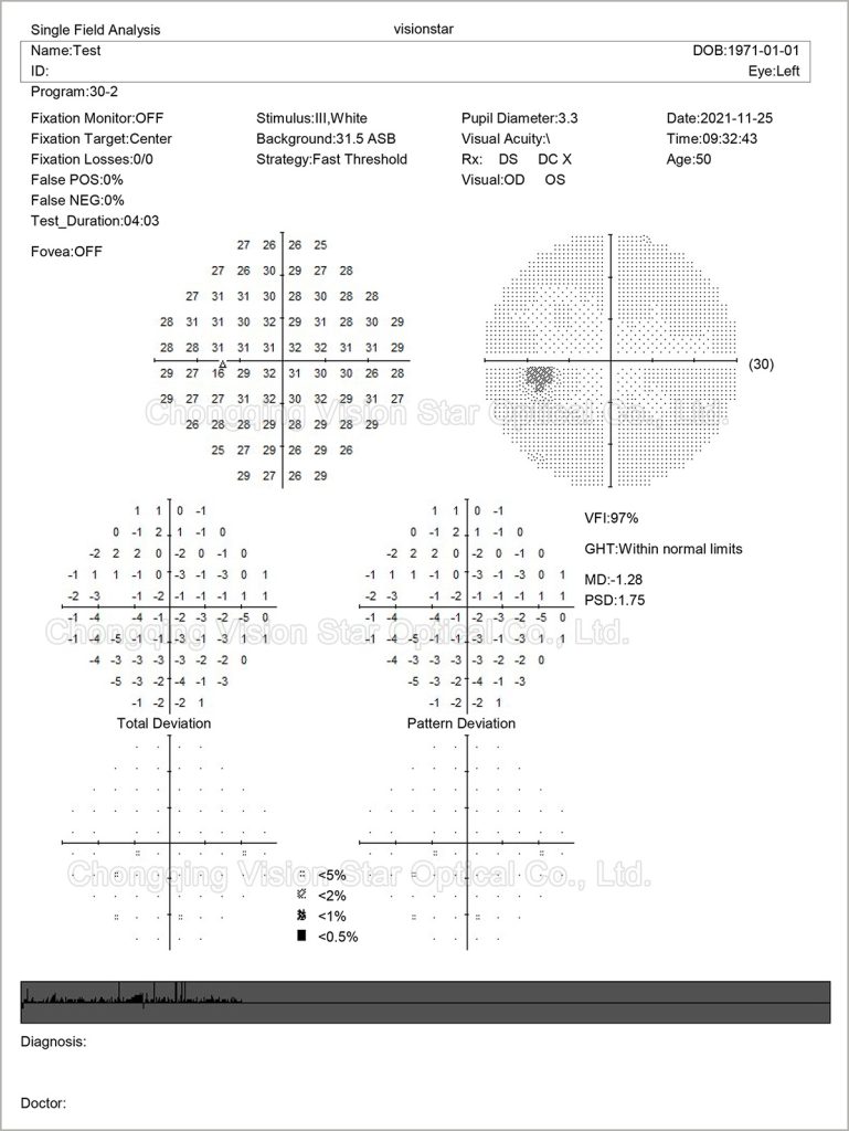Best Price BIO-1000 Goldmann Type Visual Field Analyzer for sale from ...